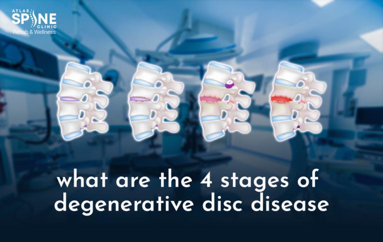 What Are the 4 Stages of Degenerative Disc Disease? - Atlas Spine Clinic