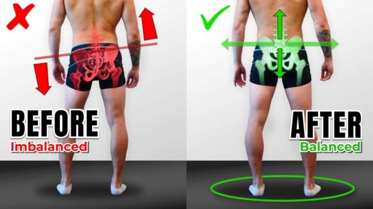 Uneven Hips? What Causes It And How To Fix It Naturally - Atlas Spine ...